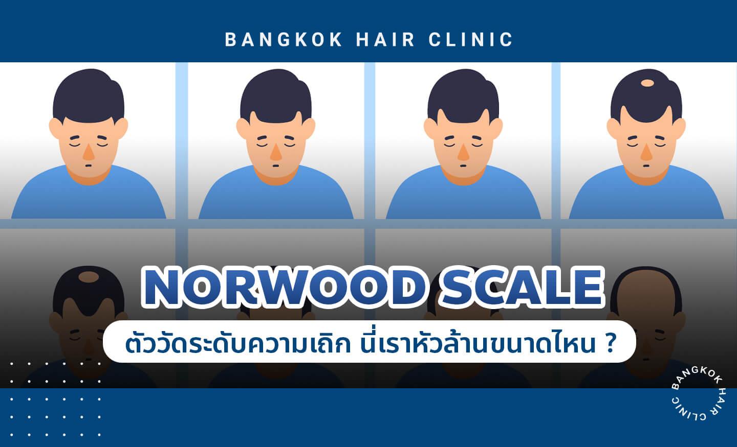 นี่เรา 'หัวล้าน' ขนาดไหน? มารู้จักกับ Norwood Scale (ตัววัดความเถิก ...